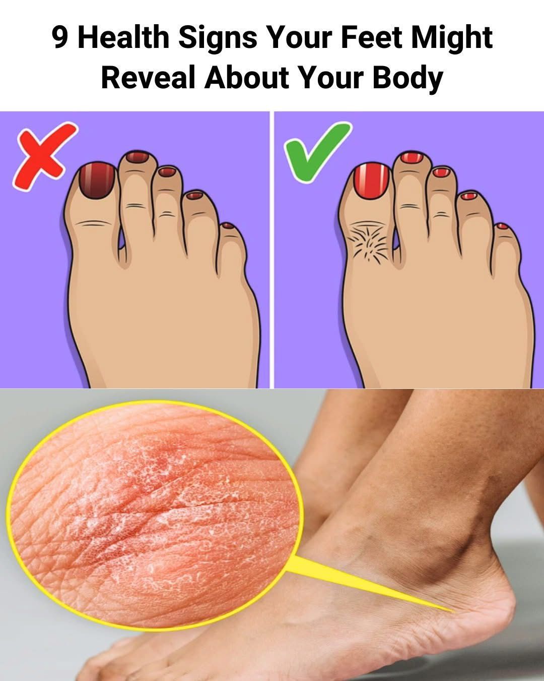 10 Ways Your Feet Are Telling You Something About Your Health - Amazing