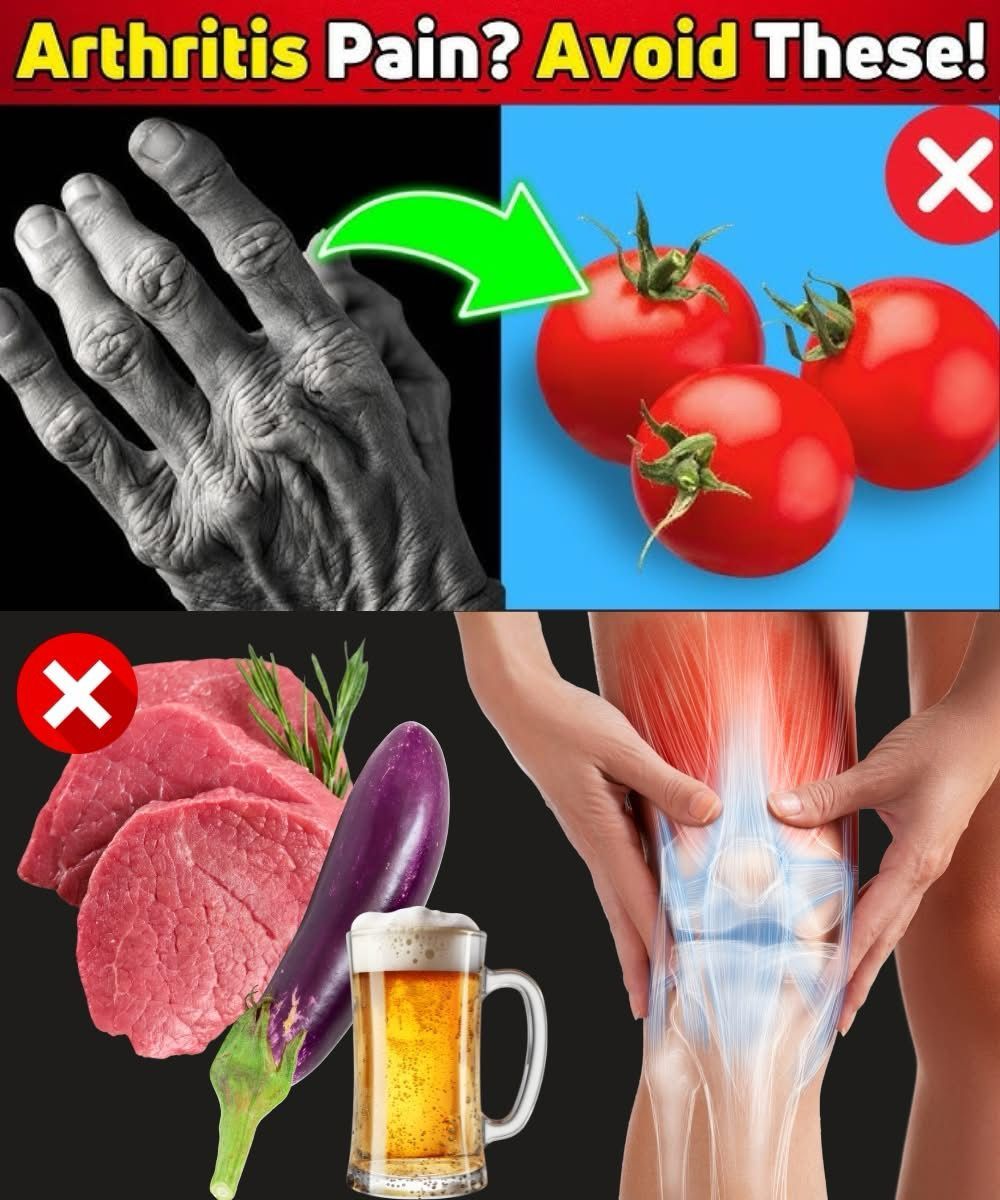 10 of The Worst Foods For Arthritis - Amazing