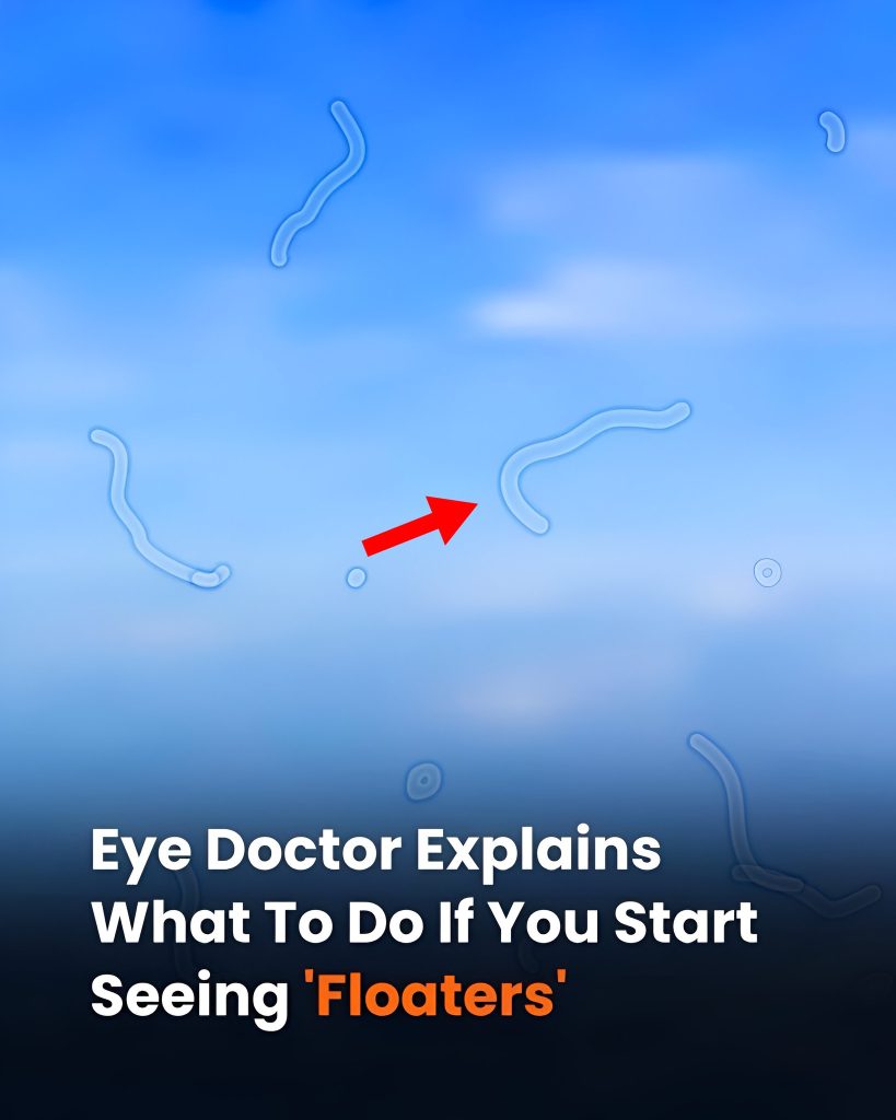What Are Eye Floaters? Here What To Do If you Start Seeing Them ...