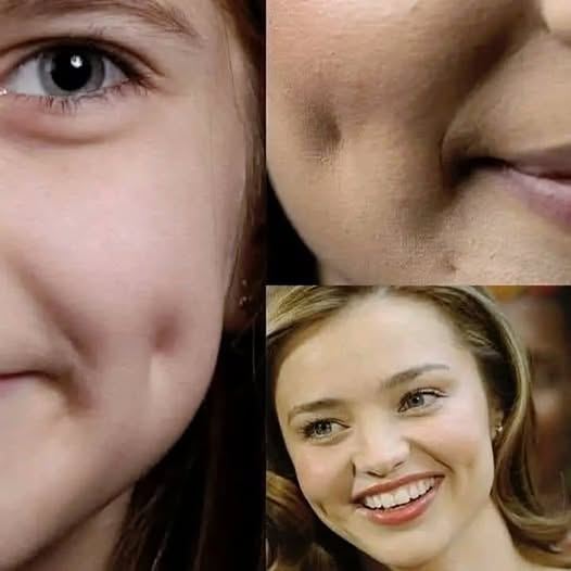 The Secret Meaning of Dimples Most People Don’t Know - Amazing