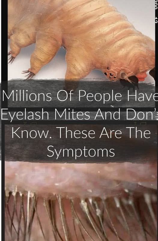 The Creepy Truth About Eyelash Mites and How to Spot Them - Amazing